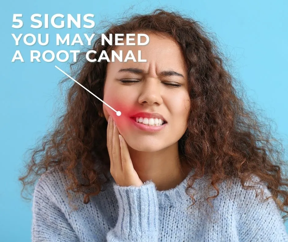 Five Signs You Might Need A Root Canal